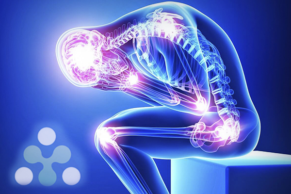 Clínica Médica Florianópolis, Palhoça e Tubarão | REUMATOLOGIA